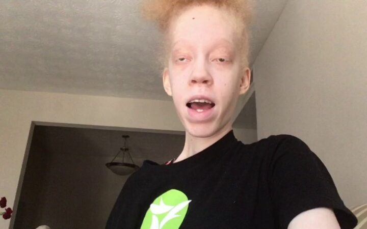 Shayydee Net Worth, Age, Height, Weight, Early Life, Career, Dating ...